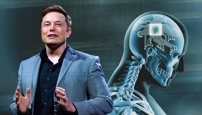 Elon Musk Klaim Perusahaannya Berhasil Tanam Chip di Otak Manusia ... Elon Musk Klaim Perusahaannya Berhasil Tanam Chip di Otak Manusia ...